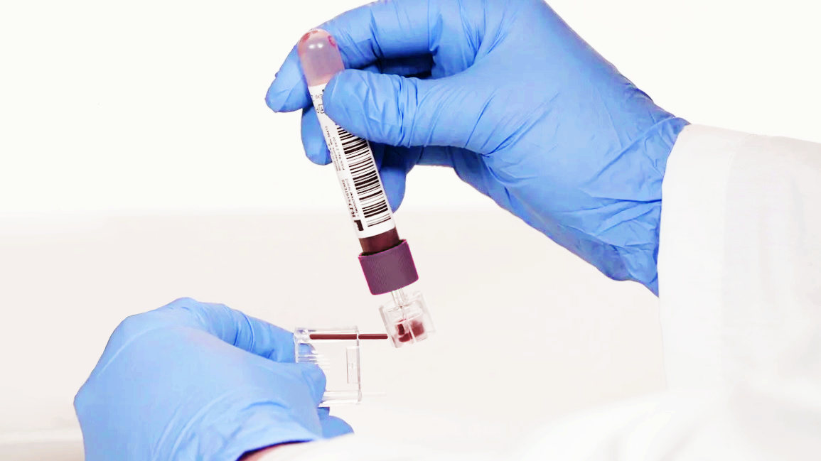 HemoScreen FSED CBC Analyzer